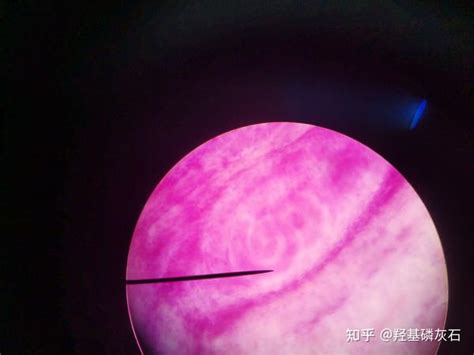 寄生虫实验——旋毛虫 知乎