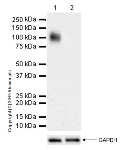 Anti Lilrb1 Antibody [epr22861 6] Ab238145 Abcam