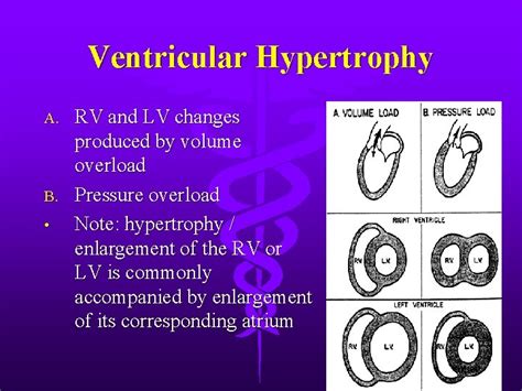 Practical Electrocardiography Conditions Affecting The Left And Right