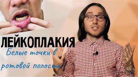 ЛЕЙКОПЛАКИЯ / Что делать / Как лечить - YouTube