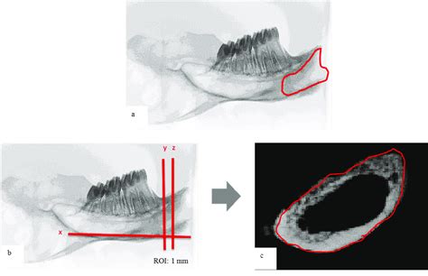 Micro Computed Tomography Micro Ct Analysis A Radiographic Image
