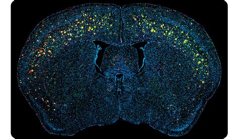 β Amyloid Transgenic Models Of Alzheimers Disease App Ps1 Models Biospective