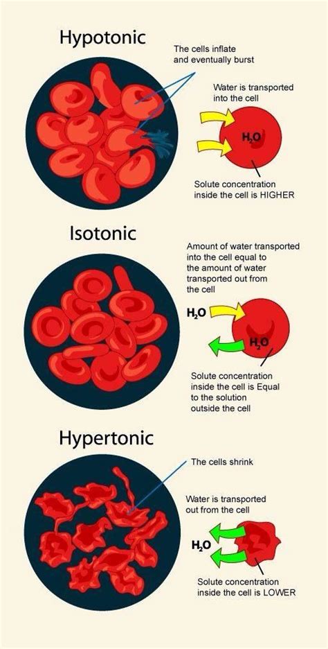 Hypo Iso Hyper Tonic Nursing School Nursing School Tips Nursing