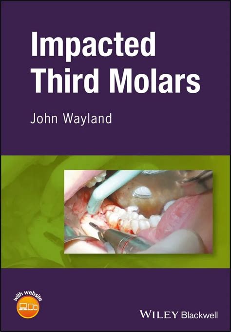 Impacted Third Molars Livres Médicaux Algerie