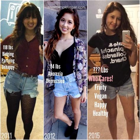 Anorexia Before And After Weight Loss