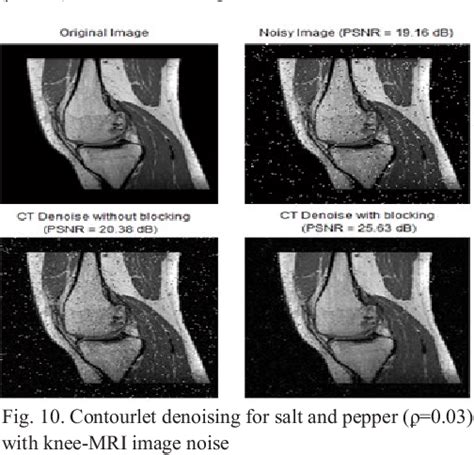 Figure 10 From Image Denoising Using Contourlet Transform With Variable