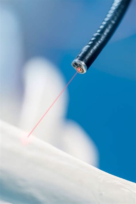 Bone Surgery Using Laser Technology Werner Siemens Stiftung