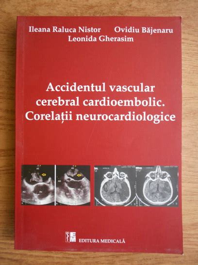Ileana Raluca Nistor Accidentul Vascular Cerebral Cardioembolic Corelatii Neurocardiologice