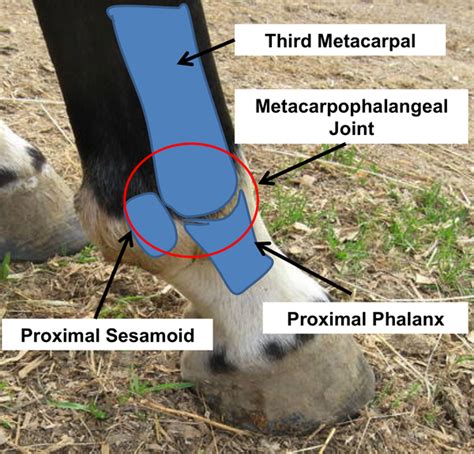 Metacarpophalangeal Joint Anatomy