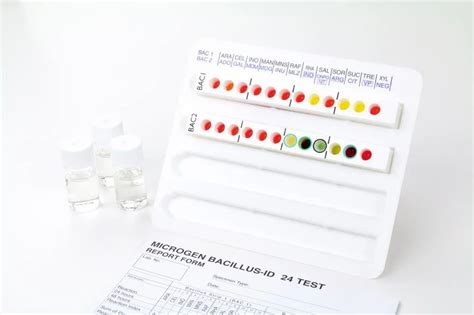 Microbial Identification System At Best Price In India