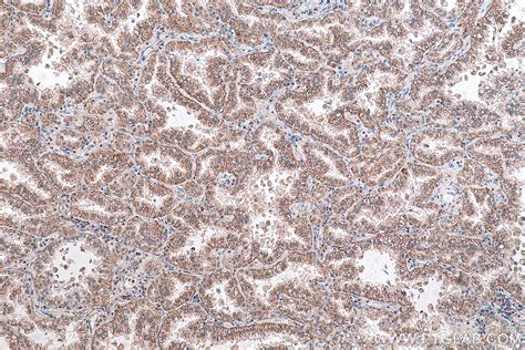 Ihceasy Gstcd Ready To Use Ihc Kit Khc0787 Proteintech 武汉三鹰生物技术有限公司