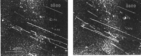 Two Weak Beam Dark Field Electron Micrographs Of A 110 Thin Foil