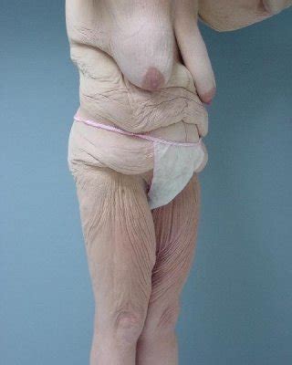 Old Mature Granny Porno Foto S PICTOA