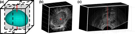 Automatic Prostate Segmentation Using Deep Learning On Clinically