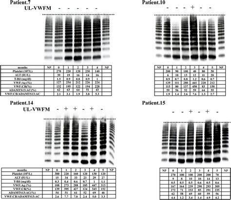 Vwf Multimer Analysis In Patients Without Cali Who Were Not Treated
