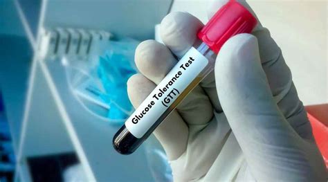 Myhealth Media Blogcard Images None F6d09993 Ad0c 457b