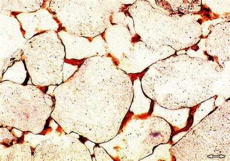 Types Of Microstructures 1