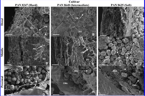 Scanning Electron Micrographs Of Distal Middle And Proximal Sections