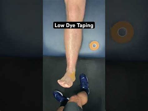 Low Dye Taping Taping Physiotherapy Physio Plantarisfacitis Plantarfascia Shinsplints