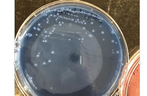 Solved How To Determine Which Bacteria Was Growing On This