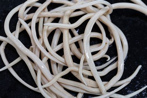 Ascariasis Adalah Penyakit Yang Disebabkan Oleh Cacing Gelang Parasit Ascaris Lumbricoides Untuk