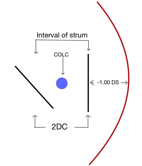 Astigmatism Charts Optominsight