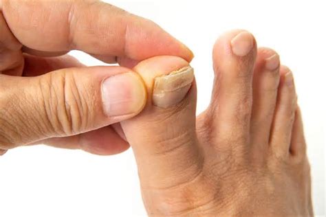 What Your Nails Say About Your Health