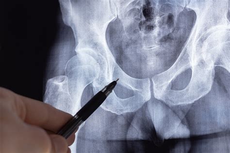 Doctor Examining Xray And Mri Mrt Ct With The Human Spine With Defects