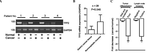 Downregulated Expression Of Tff2 Mrna In Gastric Cancer Tissues And The