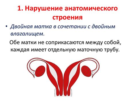 Аномалии развития и положения женских половых органов презентация онлайн