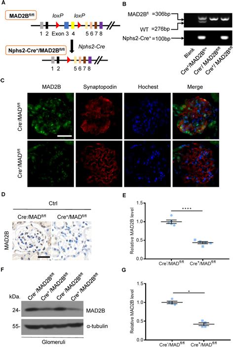 MAD2B Promotes Podocyte Injury Through Regulating Numb Dependent Notch