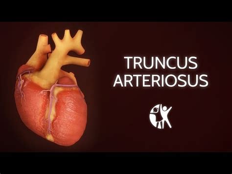 Truncus Arteriosus