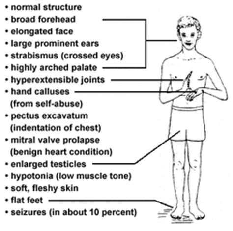 Fragile X Low Incidence Exceptionalities