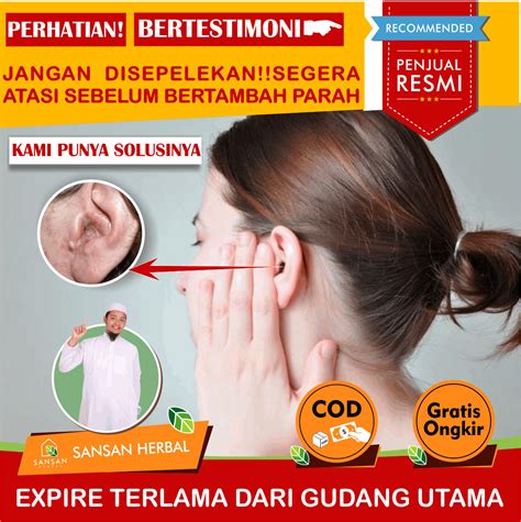 Obat Koreng Di Daun Telinga Obat Daun Telinga Korengan Salep Daun Telinga Korengan Obat