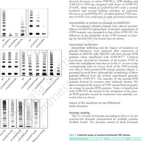 Vwf Multimeric Analysis Of Patients And Secreted Rvwf After Sds Agarose