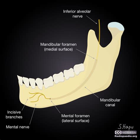 Radiopaedia Drawing Inferior Alveolar Nerve Of Mandibular Nerve English Labels Anatomytool