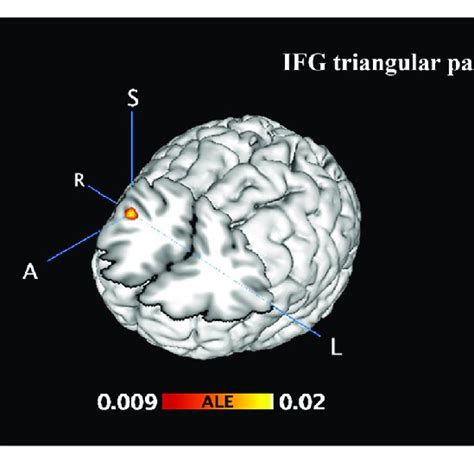 Pdf The Right Inferior Frontal Gyrus Plays An Important Role In