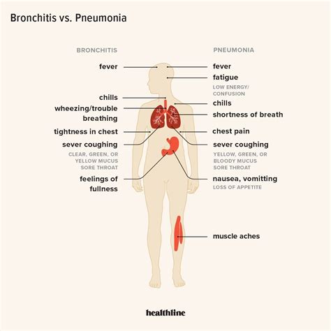 Bronchitis Vs Pneumonia How To Tell