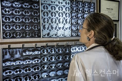 불필요한 방사선 피폭 막는 검사 가이드라인 나왔다 헬스컨슈머