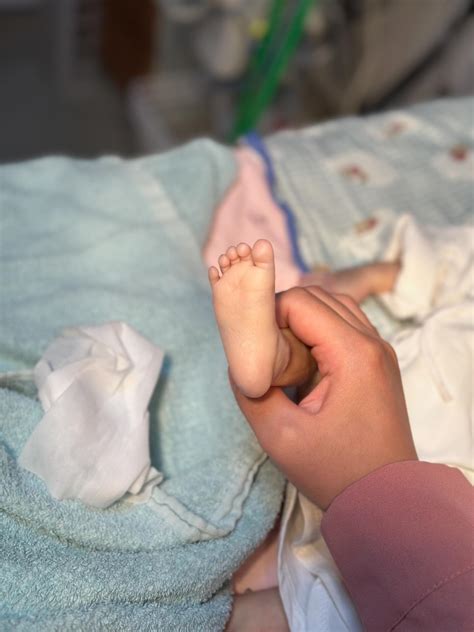 20241212 20250107 1507 出生26天 我的小寶貝女兒去當小天使了👼 344早產兒、呼吸衰竭、缺氧缺血腦性病變