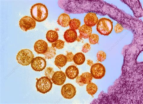 Sin Nombre Virus Particles Tem Stock Image C0142394 Science