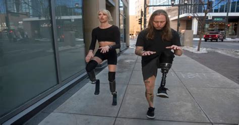 Gait Analysis Sydney 7 Powerful Benefits To Transform Your