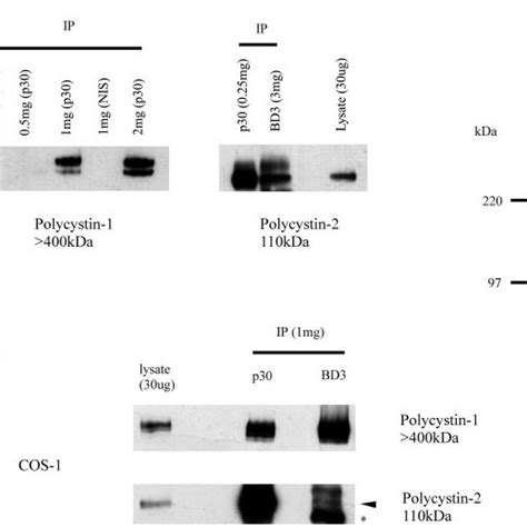 Modular Structure Of Polycystin 1 And Polycystin 2 Showing The