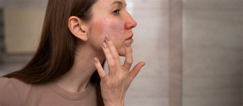 Calcium Deficiency Symptoms On Skin By Tipshealthyblogs Dec 2023