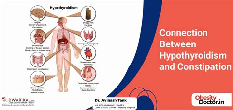 Connection Between Hypothyroidism And Constipation Dr Avinashtank Is A Super Specialist Mch