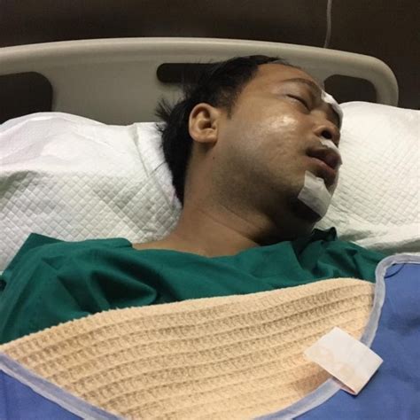 Pengacara Tv3 Ahmad Fedtri Yahya Cedera Jatuh Basikal Kosmo Digital