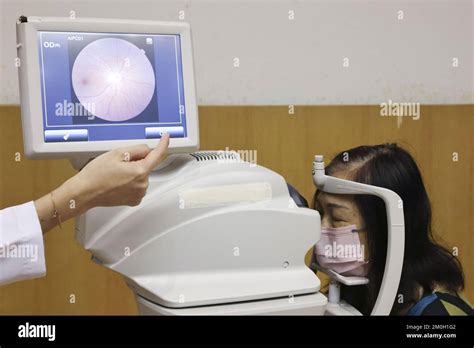 Cuhk Led International Team Develops The Worlds First Ai Model Using Fundus Photographs Alone