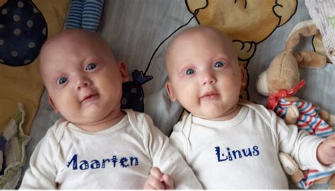 Whats Going On With The Research For X Linked Hypohidrotic Ectodermal Dysplasia Xlhed And