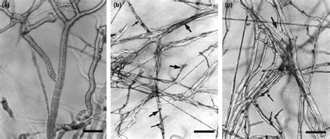 Effect Of Essential Oils On Hyphal Morphology Of S Sclerotiorum Under