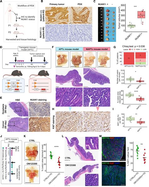 Nuak1 Activates Stat5gli1sox2 Signaling To Enhance Cancer Cell